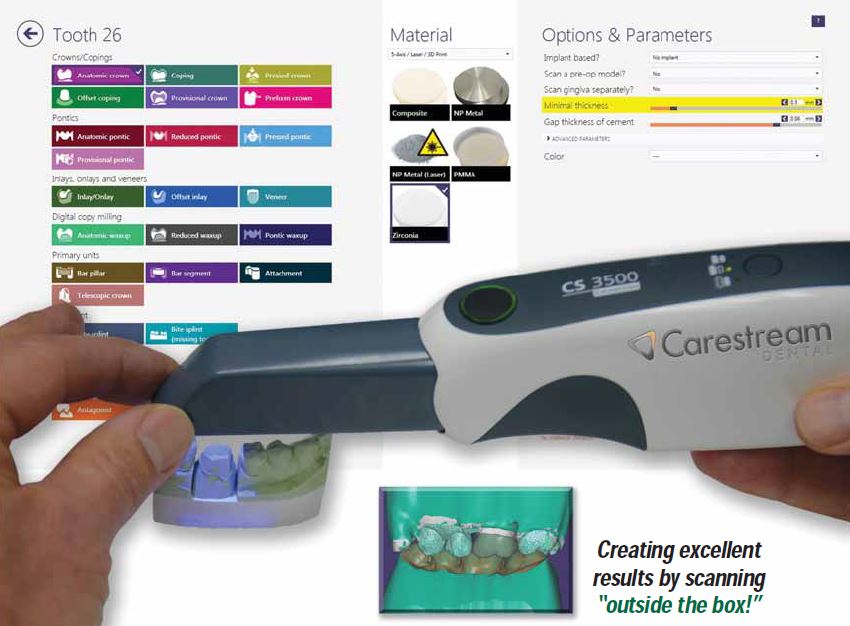 A comparison of Dental Scanners: 3M ESPE Lava, 3shape and EmCAD