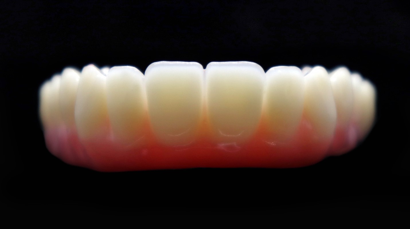 Flexcera™ resin is now available at Emerald Dental Works