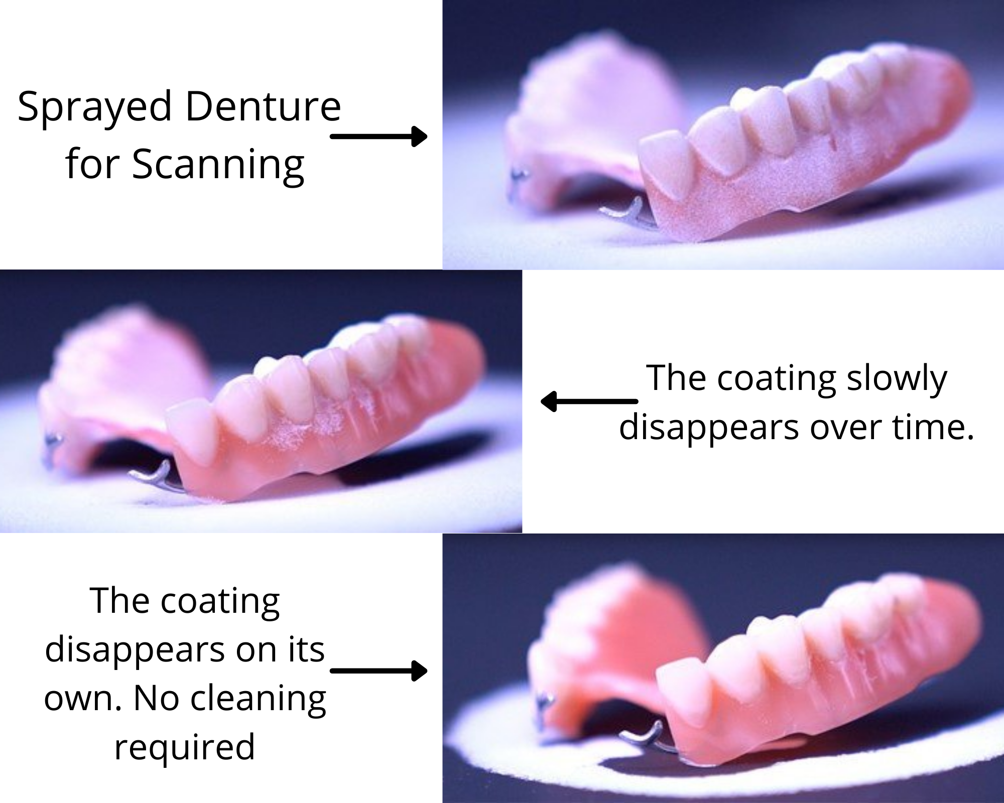 SCANTIST 3D - First vanishing extraoral dental 3D Scan Spray