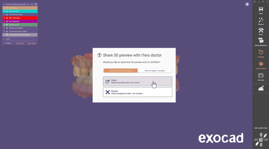 Exocad DentalCAD 3.2 Elefsina